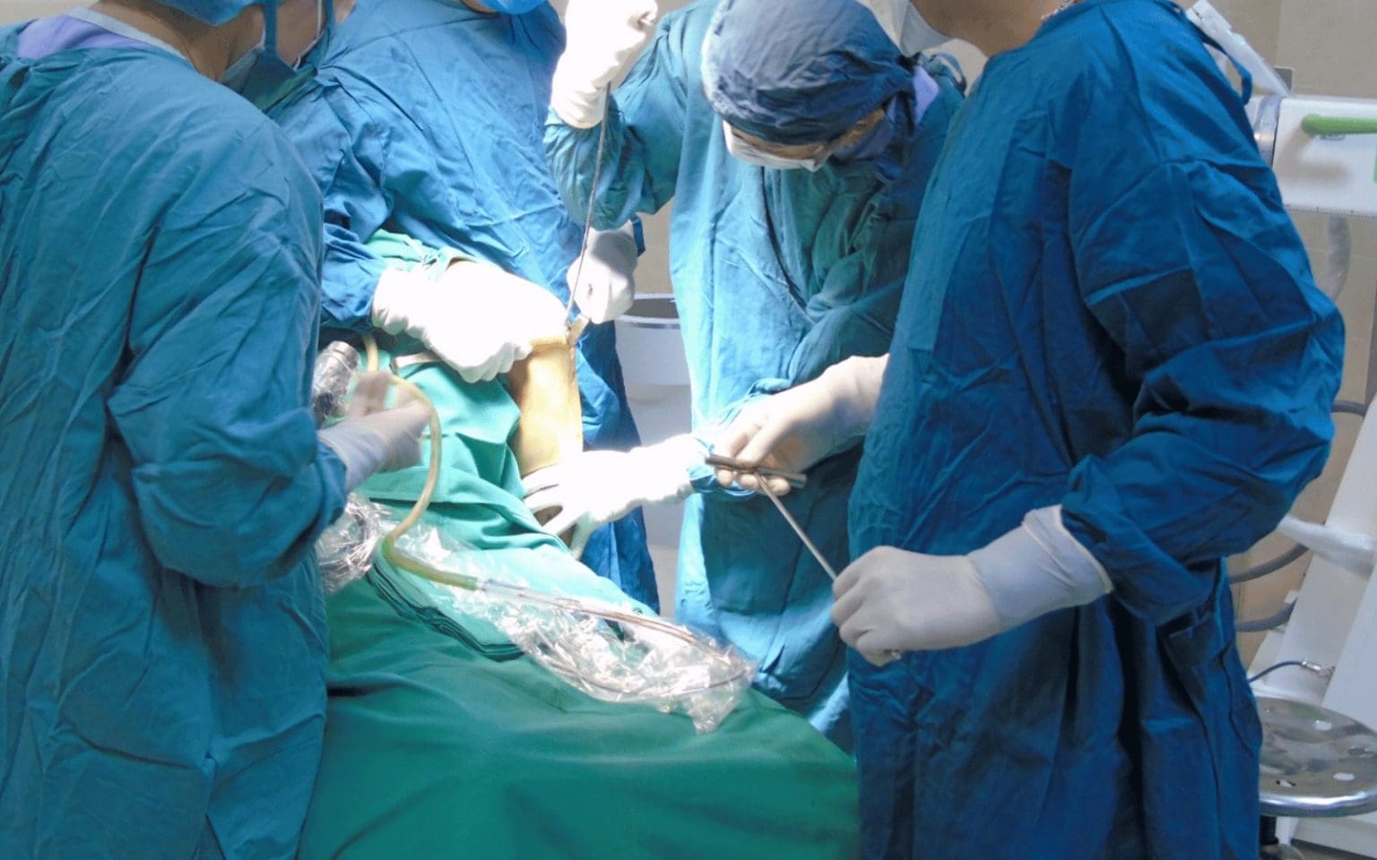 Phẫu thuật đóng đinh kín PFNA (Proximal Femoral Nail Antirotation)